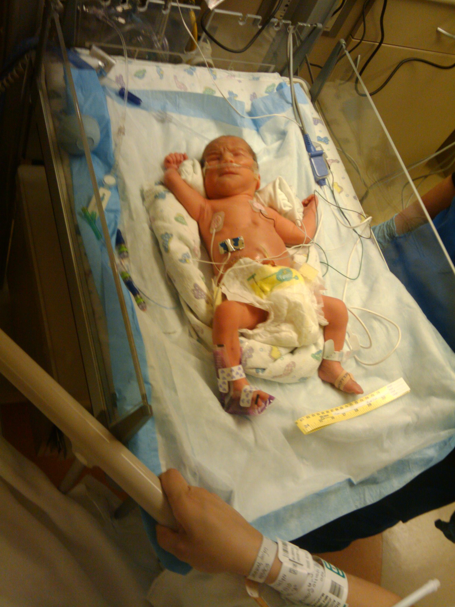 Neonatal Nurses: Caring for the most vulnerable in our world when they ...